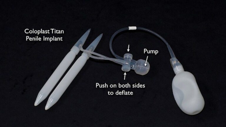 Penile Implants Types | World-Renowned Specialist