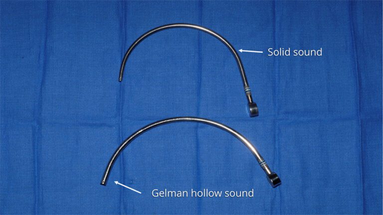 Pelvic Fracture Urethral Injury | World-Renowned Specialist